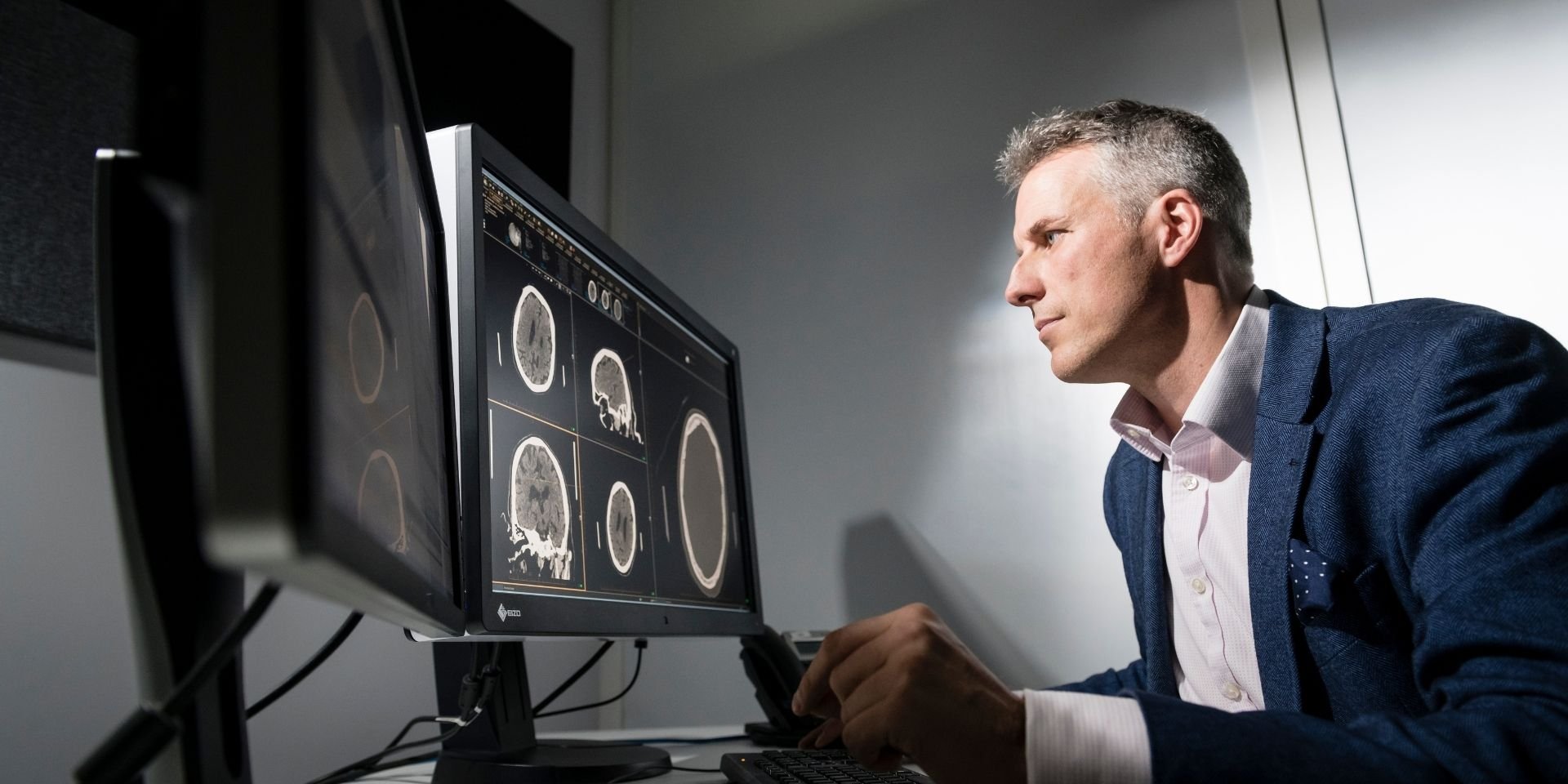 Everlight launches enhanced thrombectomy reporting service for UK and ...